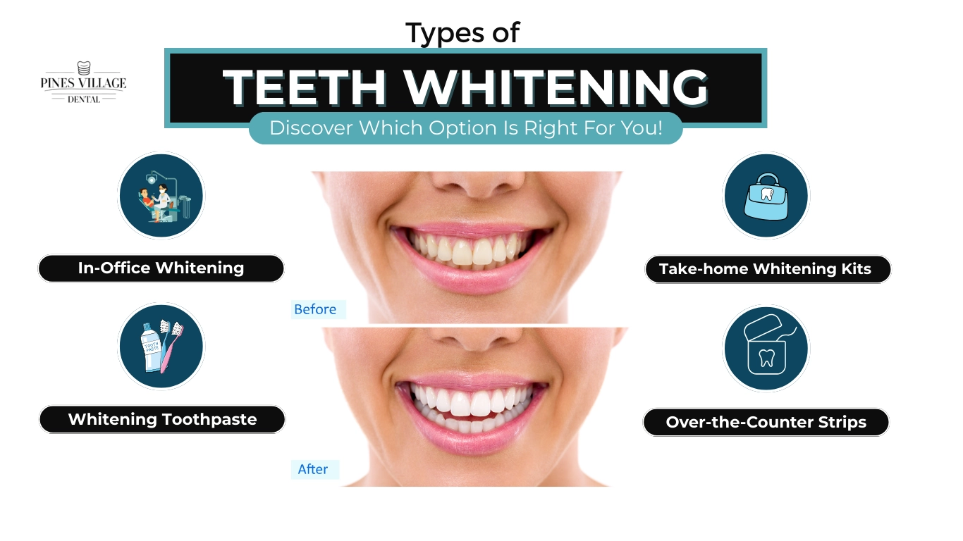 Types of Teeth Whitening in Pembroke Pines, FL